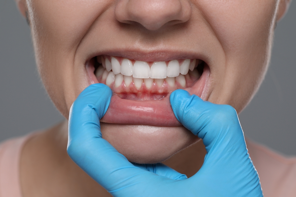 When to See a Periodontist - Anchor Dental & Implant Center